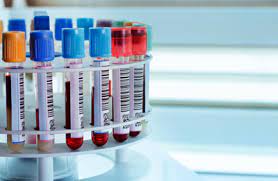 Analyse sanguine - OUAGADOUGOU.ONLINE